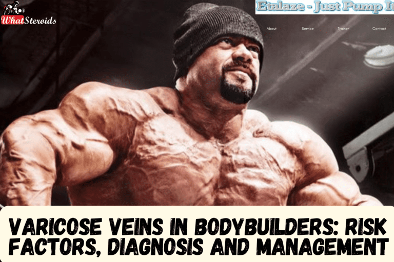 Varicose Veins in Bodybuilders: Risk Factors, Diagnosis and Management ...